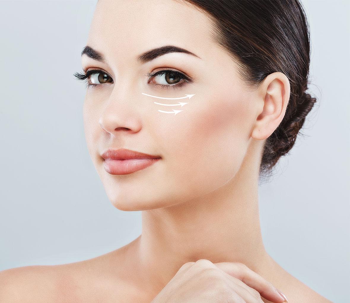 Facial & Under Eye Volume - Aesthetic Nurse Suzie